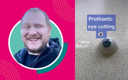 Prosthetic eye cutting - Henshaws